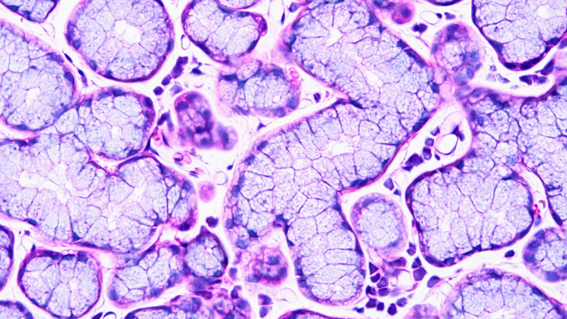 Frontiers IN VITRO ASSESSMENT OF CHEMICAL SURFACE TREATMENTS ON THE Frontiers IN VITRO ASSESSMENT OF CHEMICAL SURFACE TREATMENTS ON THE